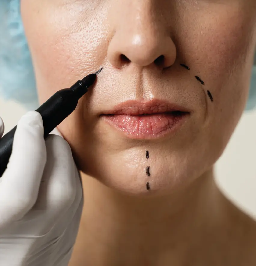 Plastic Surgery – Viva Skintech